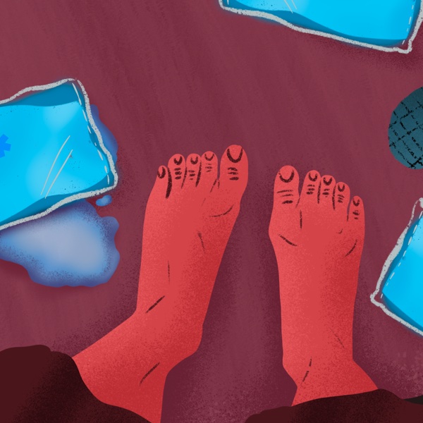 Triptans for Migraine Treatment