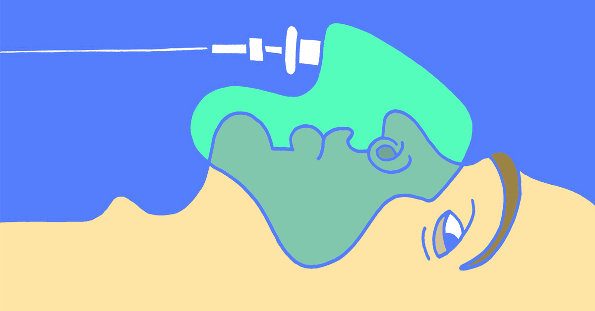 Managing an Anesthesia-Triggered Migraine in the Hospital